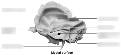 Module 1 Temporal Bone Medial Surface Diagram Quizlet