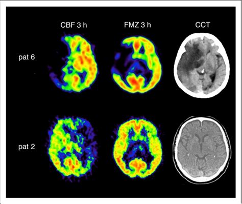How Does Radionuclide Imaging Work At Felipe Heidt Blog