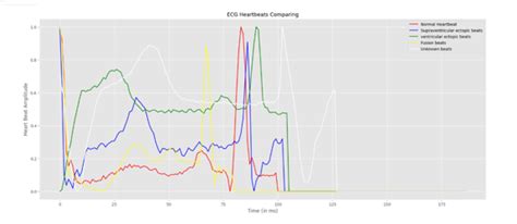 classification of heartbeats using convolutional neural networks