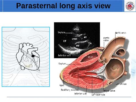 Transthoracic Echocardiography Standard Imaging Of A