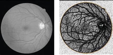 active contour based segmentation techniques for medical image analysis
