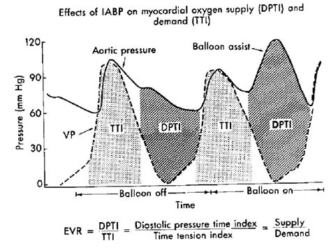 Iabp Principle Hemodynamic Timing Weaning 2016 Background Asmiha …