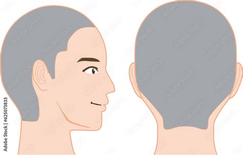 Vector de Stock 頭のツボの図解イラスト 男性 Adobe Stock