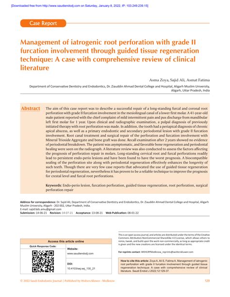 Pdf Management Of Iatrogenic Root Perforation With Grade Ii Furcation