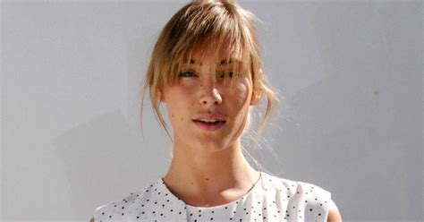 Jessica Ruscoe Was Asked To Remove Moles For Modelling Career