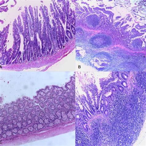 Esophageal Mucosa Microscopy Showing The Standard For Measuring The