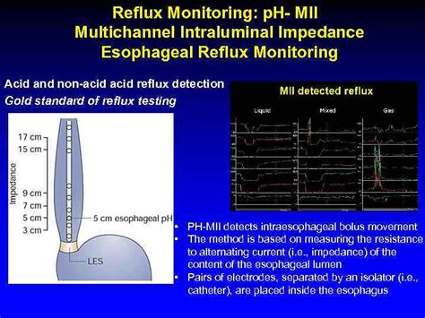 Esophagus Rita Brun Md Gastroenterology Department Rambam Health