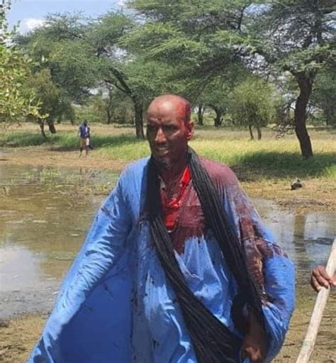 مشاهد مصورة مثيرة من الجرحى في أحداث أم افنادش ميادين