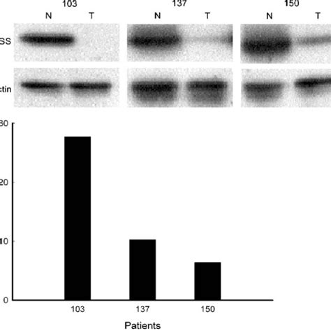 Down Regulation Of Ass Protein In Ccrcc Tissue Pairs The Download