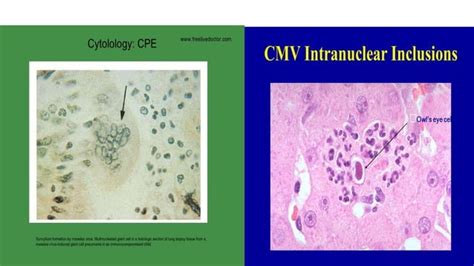 Cytopathic Effect Notes By Sanju Sah Pptx