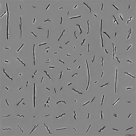 Bacteria From The Oral Cavity Phase Contrast Ob 90x Scrolller