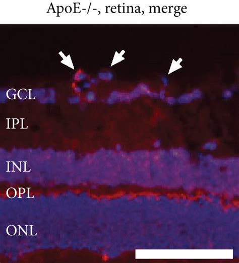 Immunostainings For The Ox Ldl Receptor Lox 1 In Retinal