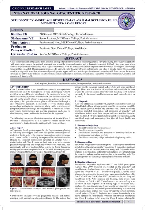 Pdf Orthodontic Camouflage Of Skeletal Class Ii Malocclusion Using