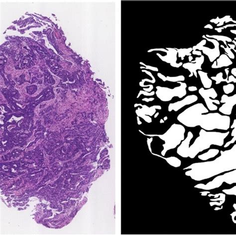 Wsi Of Colonoscopy Tissue And Ground Truth An Example Of An Rgb