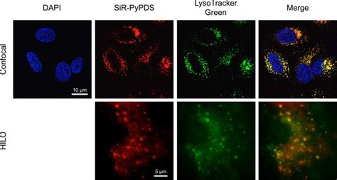 Sir Pypds Mainly Accumulates In Lysosomes Representative Confocal And