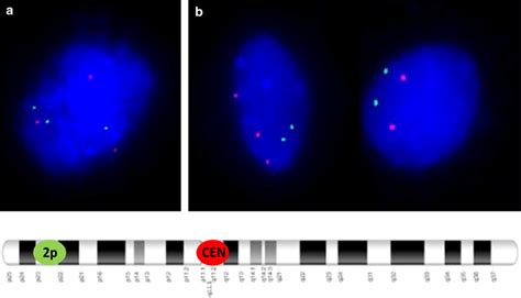 Interphase Fish Analysis Of Uncultured Placenta A And Fetal Skin B