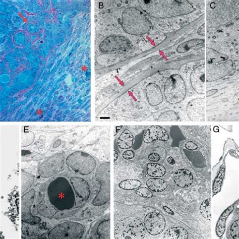 Light And Transmission Electron Micrographs Of Testicular Lesions In