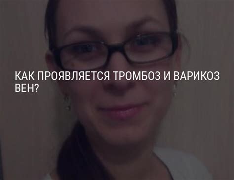 Как проявляется тромбоз и варикоз вен на ногах и руках