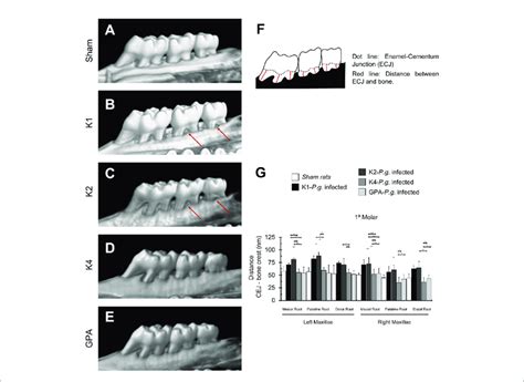 Bone Resorption In The 1st Molar A Micro Ct Reconstruction Of The