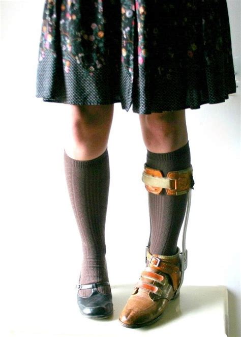 Vintage Leather Leg Brace Photography Print