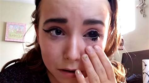 VIDEO Joven Casi Pierde Un Ojo Al Hacer Tutorial De Maquillaje En