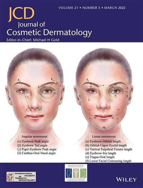 Injection Techniques For Midface Volumization Using Soft Tissue