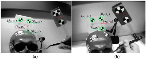 An Inertial And Optical Sensor Fusion Approach For Six Degree Of Freedom Pose Estimation