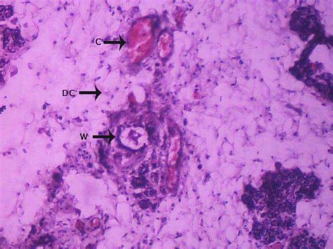 Histopathological Slides Of Granulation Tissue In Dexamethasone Delayed