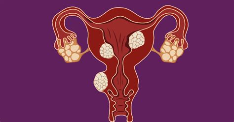 गर्भाशय का अर्थuterus Meaning In Hindi संरचना और इसके कार्य