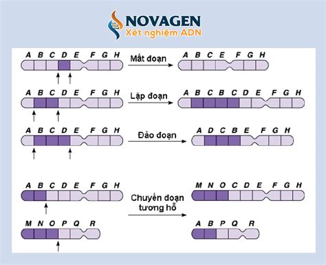 Đột Biến Nst Là Gì Tổng Quan Phân Loại Và ý Nghĩa Trong Nghiên Cứu