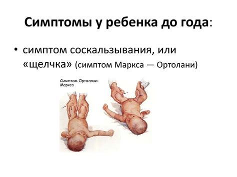 Массаж и ЛГ при дисплазии тазобедренного сустава Задачи массажа и гимнастики в детской