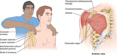 Coracoid Process How Does It Affect Vision
