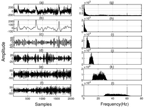 The Left Column A To F From Top To Bottom Shows Eeg Signal With