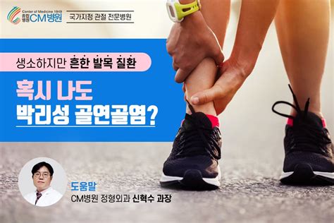 Cm병원 [흔하지만 낯설게 느껴지는 너 발목 박리성골연골염이란] 이름은 생소하지만 아주 흔한
