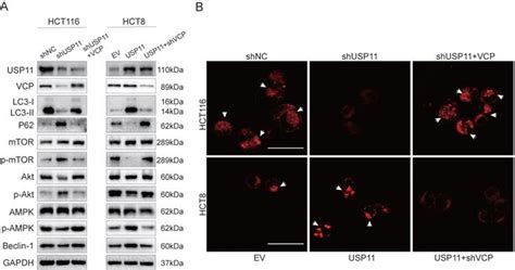 Usp11 Induce Resistance To 5 Fluorouracil In Colorectal Cancer Through