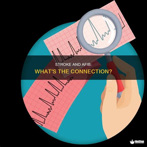 Stroke And Afib What S The Connection MedShun
