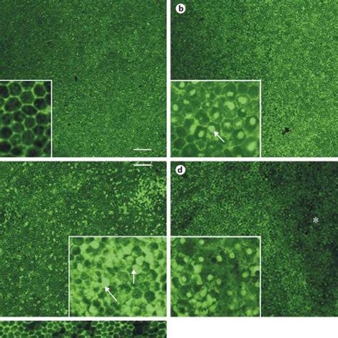 Calcein Am Staining Of Rpe Cells In Rpe Choroid Tissue Culture On Day 2 Download Scientific