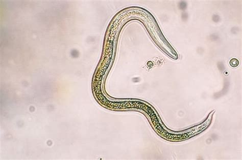 Toxocara
