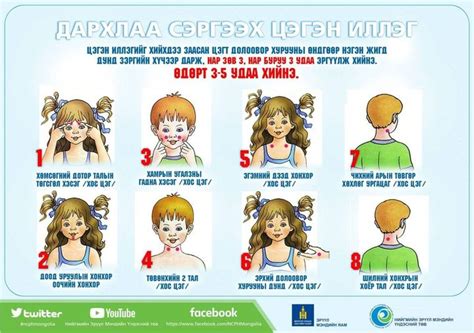 Khovdnews Mn Ковид 19 Дархлаа сэргээх цэгэн иллэг