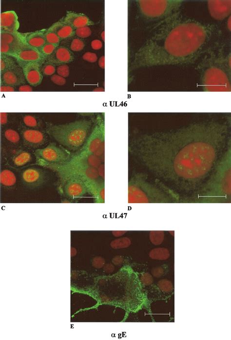 Intracellular Localization Of Prv Ul46 And Ul47 Proteins Immuno Fl