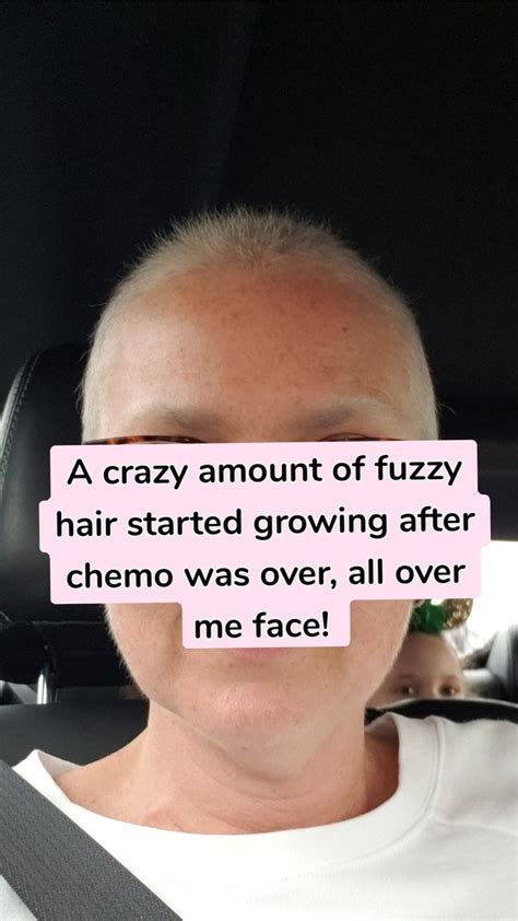 Hair Growth After Chemo Growing Hair After Chemo Hair Growth Post Chemo