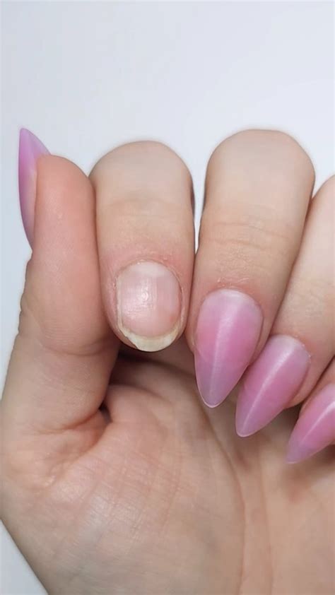 Jennifer Doyle Fusionnails • Instagram Photos And Videos