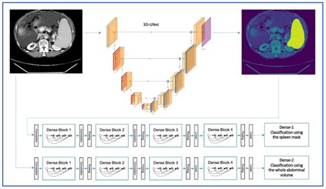 Two Stage Deep Learning Model For Automated Segmentation And