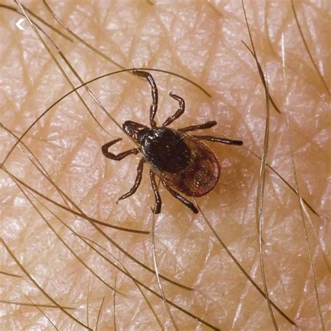 Prophylactic Antibiotics Tick Bite