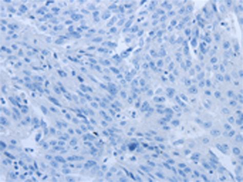 兔抗pparg多克隆抗体anti Pparg Rabbit Polyclonal Antibody 生命科学产品与技术服务 生工生物工程
