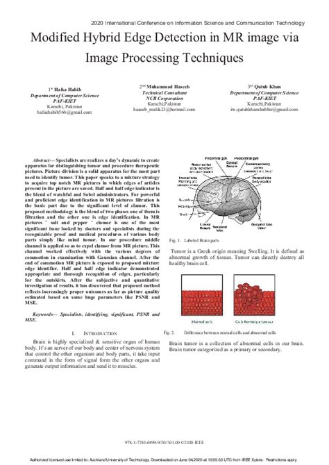 Pdf Modified Hybrid Edge Detection In Mr Image Via Image Processing