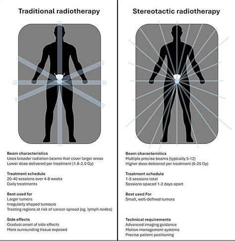 What Is Stereotactic Radiation Therapy For Prostate Cancer How Does It