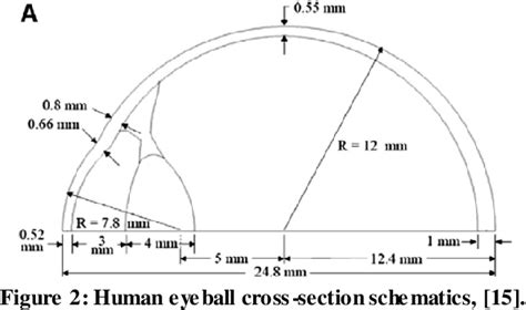 Figure 2 From Design Of Retinal Stent Using Finite Element Analysis