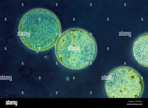 Volvox Under Microscope