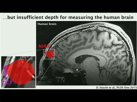 Free Video Scalable Human Brain Imaging With Time Of Flight Filtered Diffuse Optical
